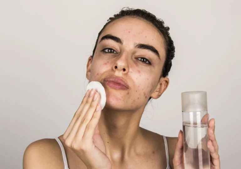 Clearing The Way: Home Remedies To Banish Acne Between Eyebrows | Malak ...