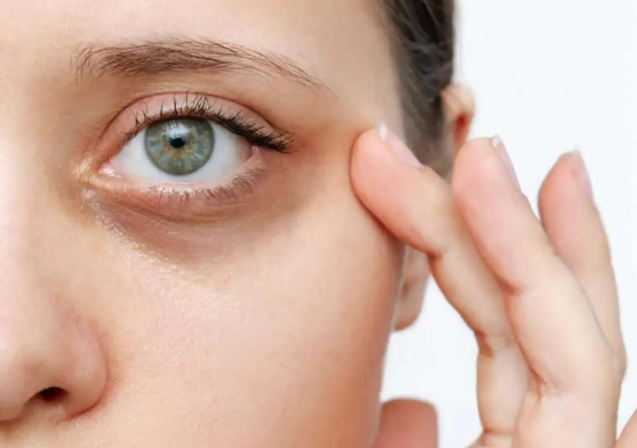 Discover Best Treatments For Dark Circles Malak Skincare