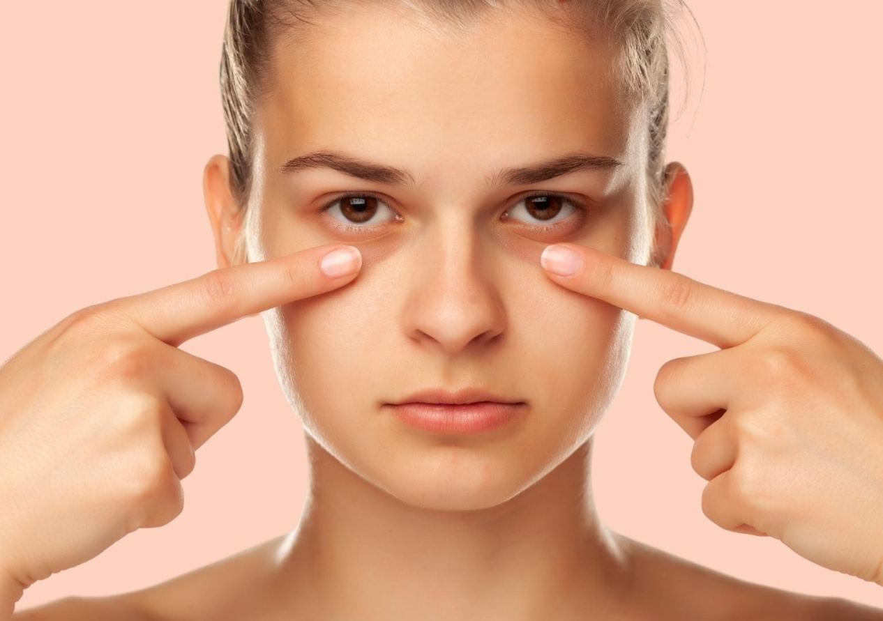 Discover Best Treatments For Dark Circles | Malak Skincare